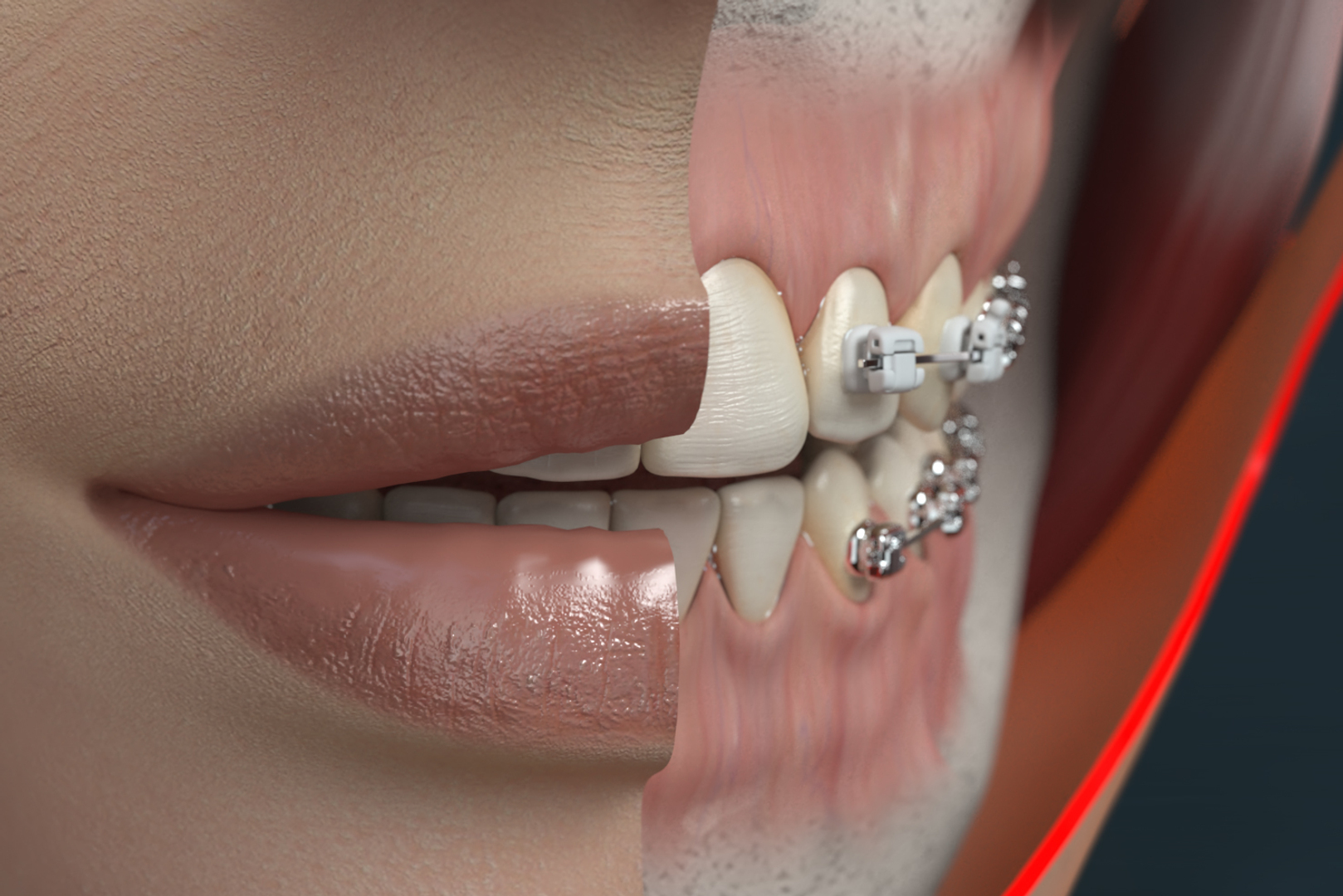 3D Model Orthodontic Mannequin V-ray Ortho - TurboSquid 1338305