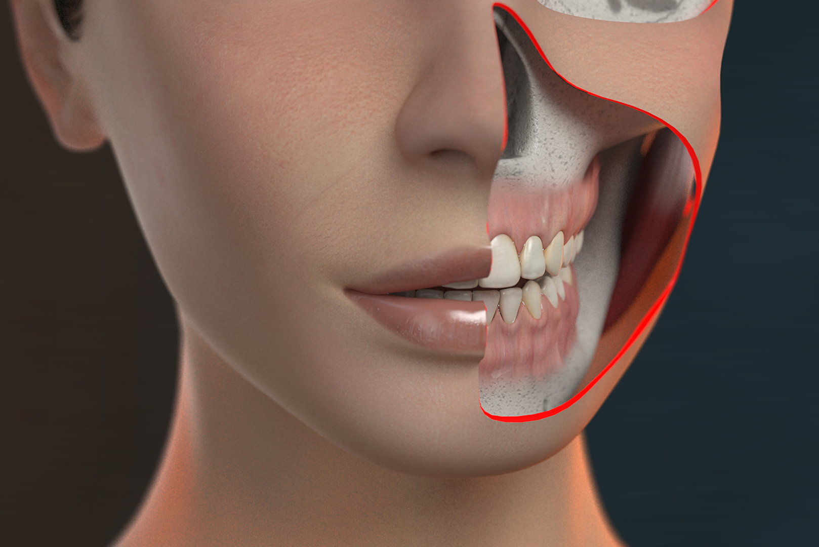 3D Model Orthodontic Mannequin V-ray Ortho - TurboSquid 1338305