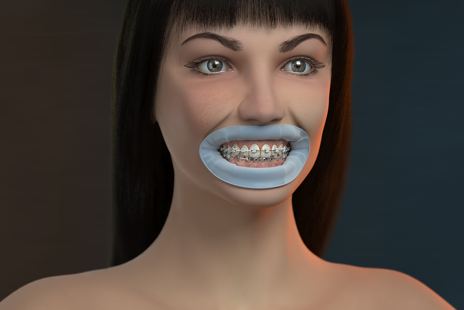3D Model Orthodontic Mannequin V-ray Ortho - TurboSquid 1338305