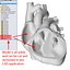 Human Heart Solidworks 3d Model