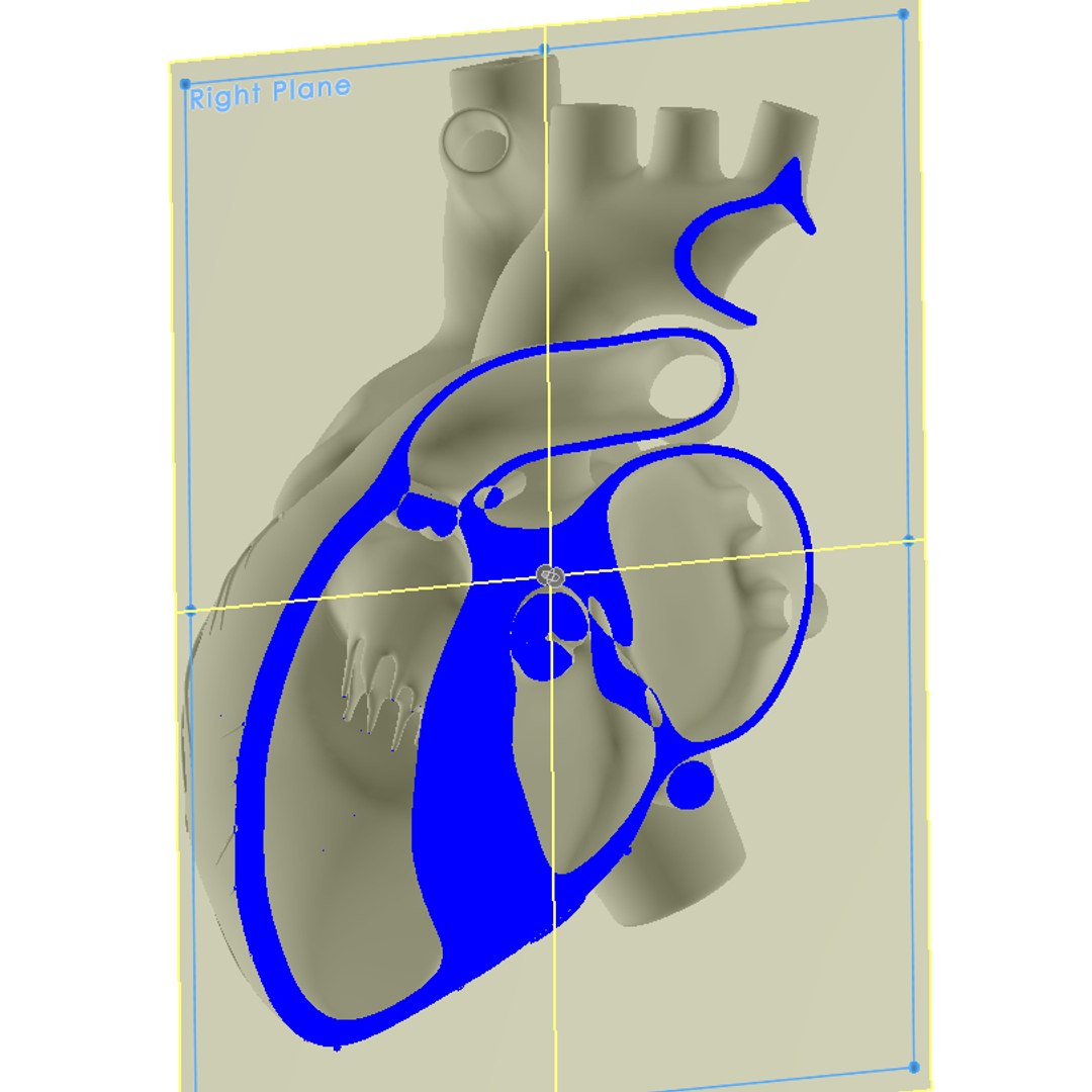 Human Heart Solidworks 3d Model
