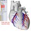Human Heart Solidworks 3d Model