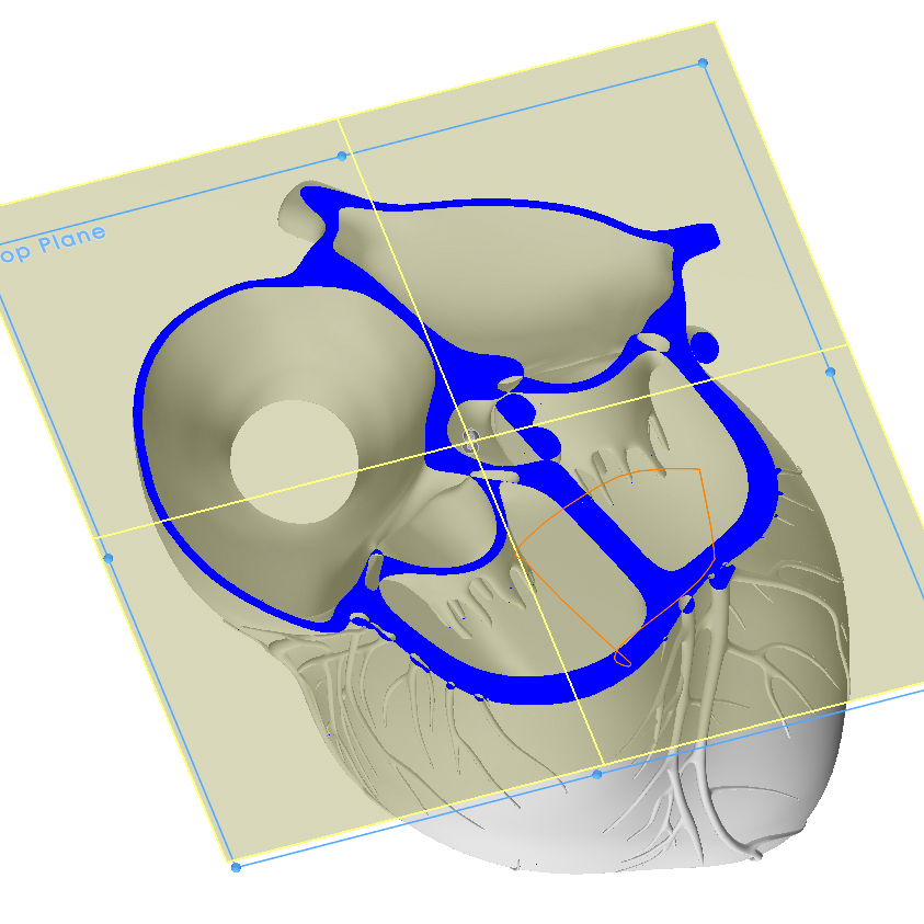 human heart solidworks 3d model