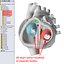 Human Heart Solidworks 3d Model