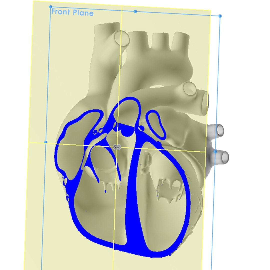 Human Heart Solidworks 3d Model