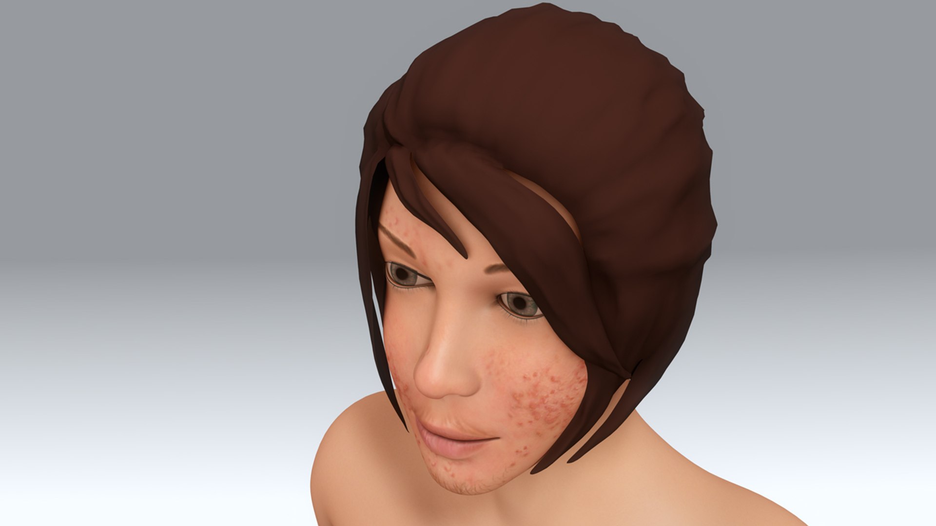 Female Pimples 3d Obj