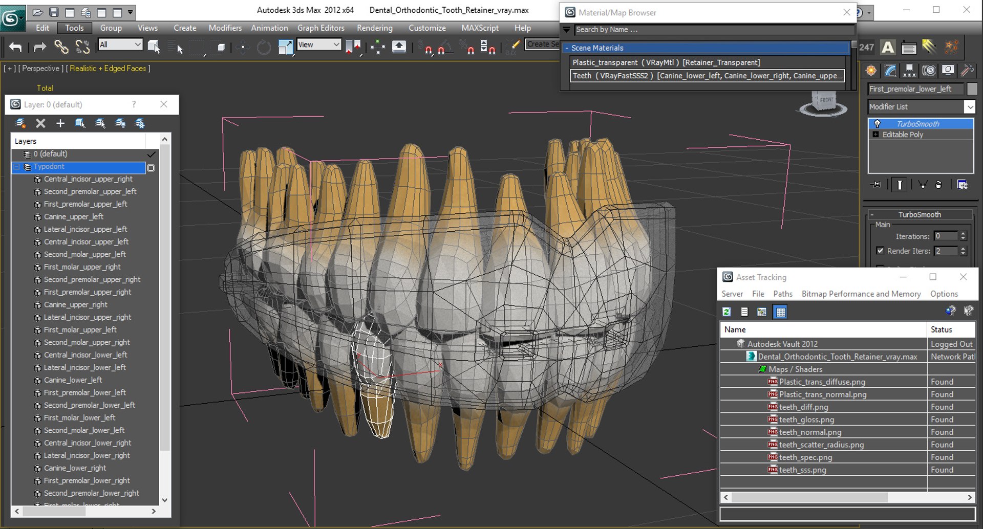 Dental Orthodontic Tooth Retainer 3D Model - TurboSquid 1318161