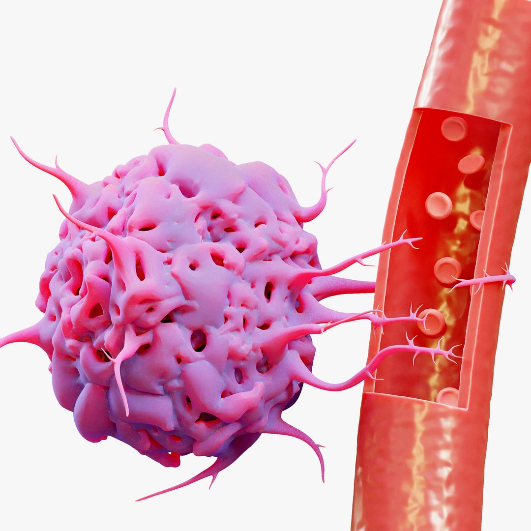 Vessel Tumor 3D Model - TurboSquid 1981231