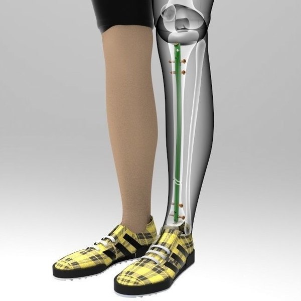 Skeletal System Nail 3D Models for Download | TurboSquid