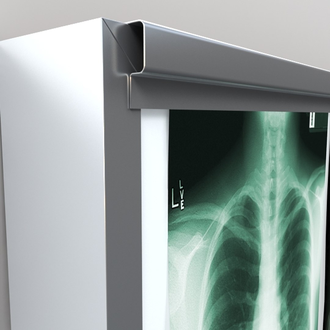 X-ray Lightbox Lighting 3d Model