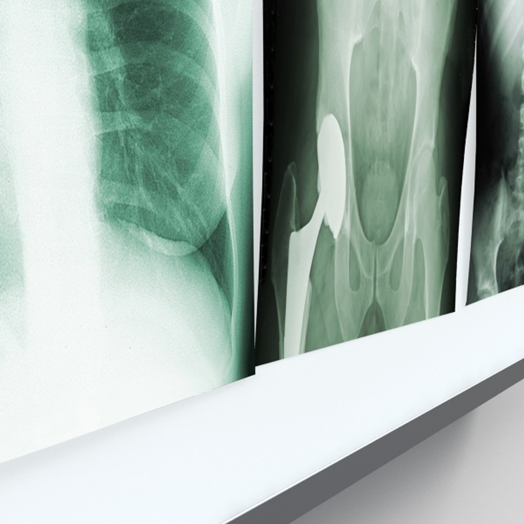 X-ray Lightbox Lighting 3d Model
