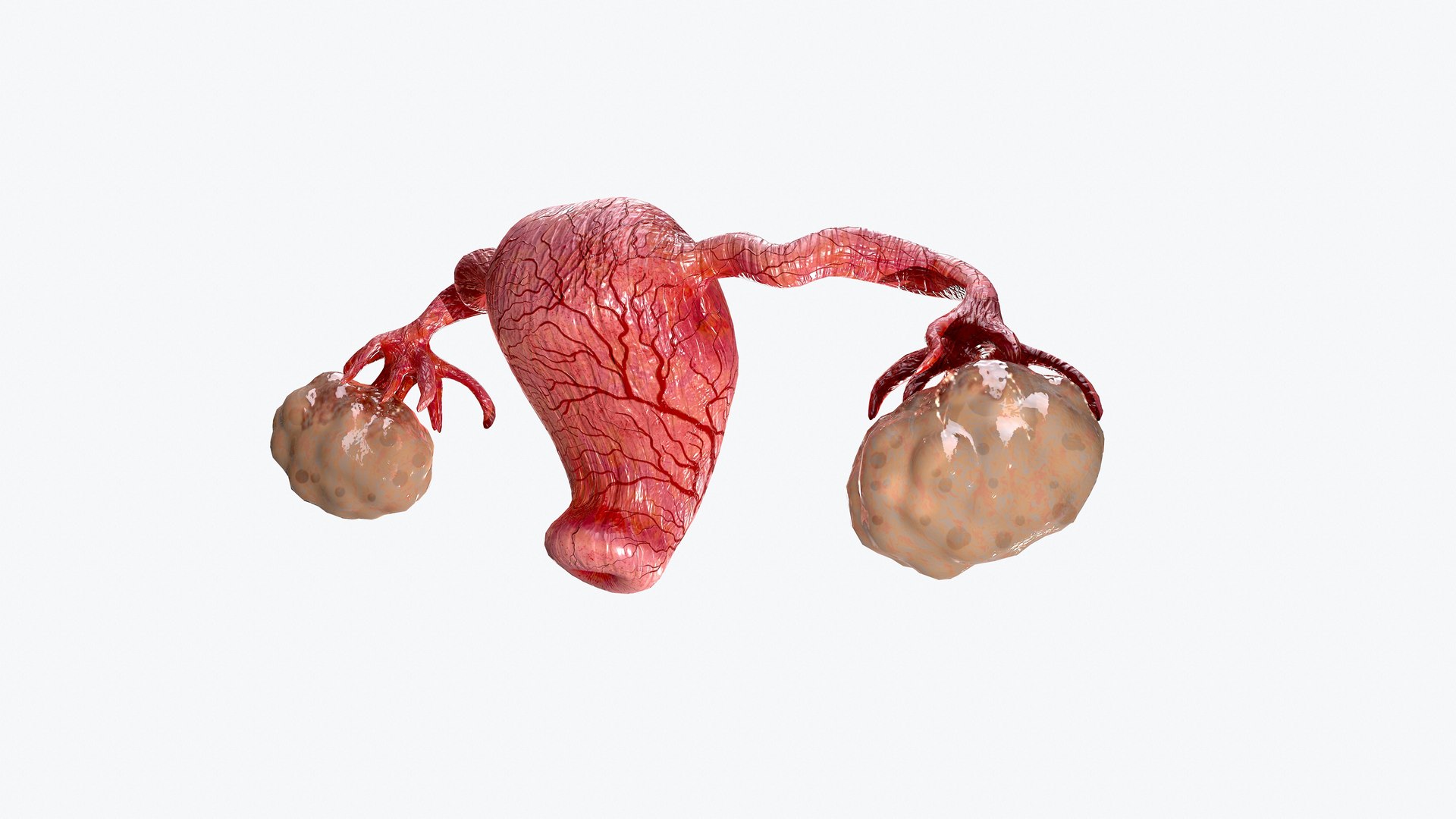 Uterus And Ovaries 3D Model - TurboSquid 1753710