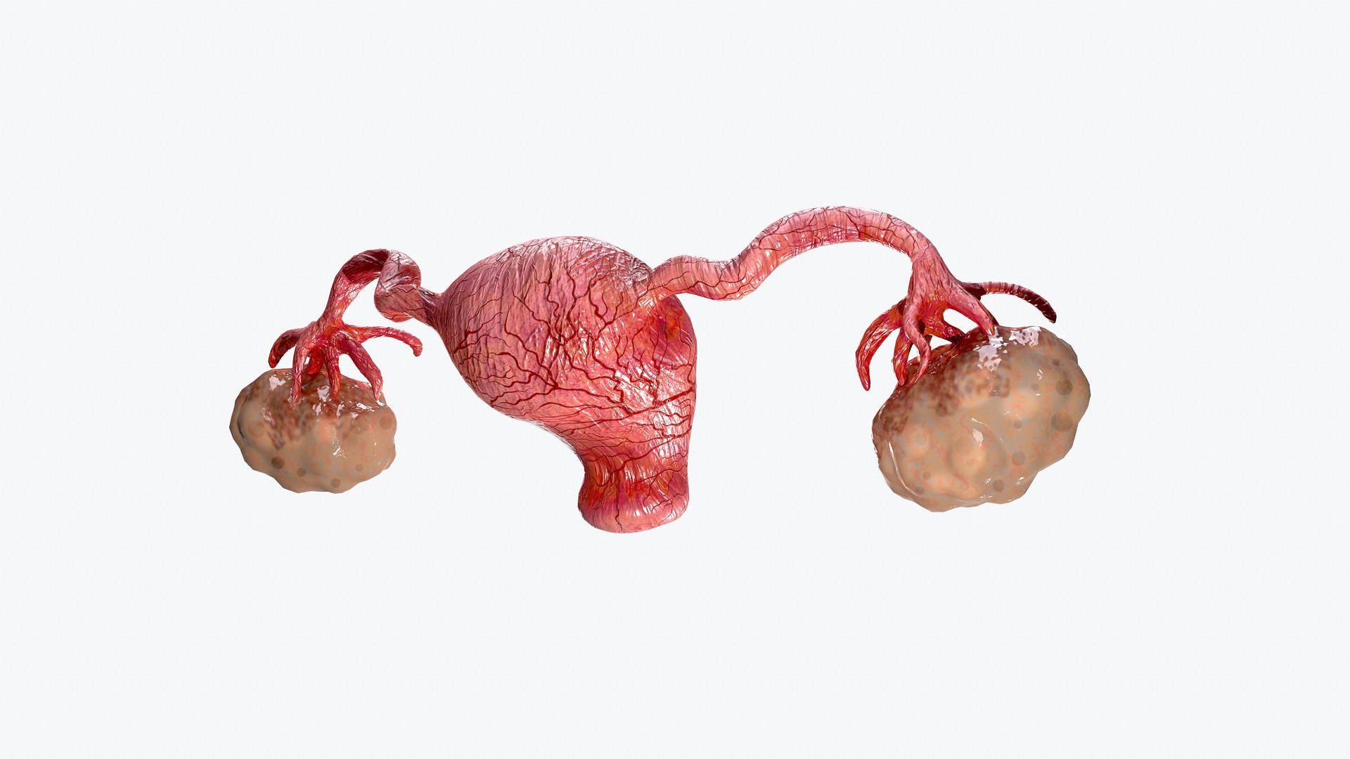 Uterus And Ovaries 3D Model - TurboSquid 1753710