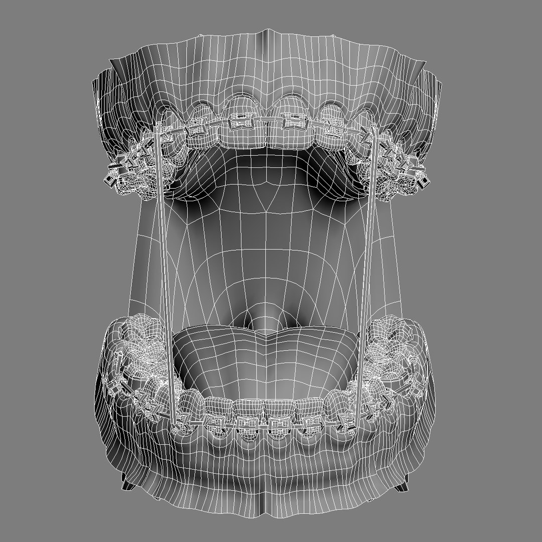 realistic dentition braces 3d max