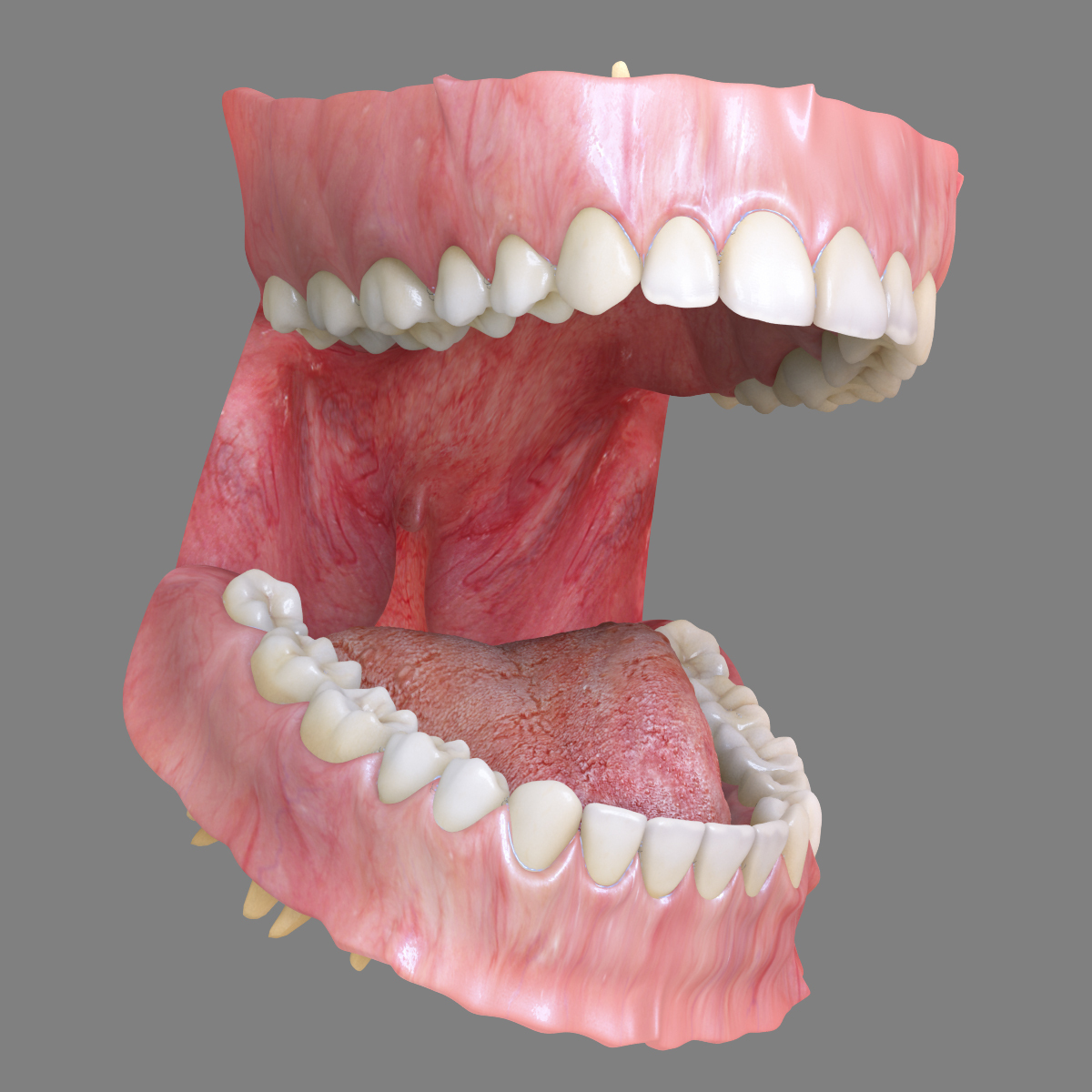 realistic dentition braces 3d max