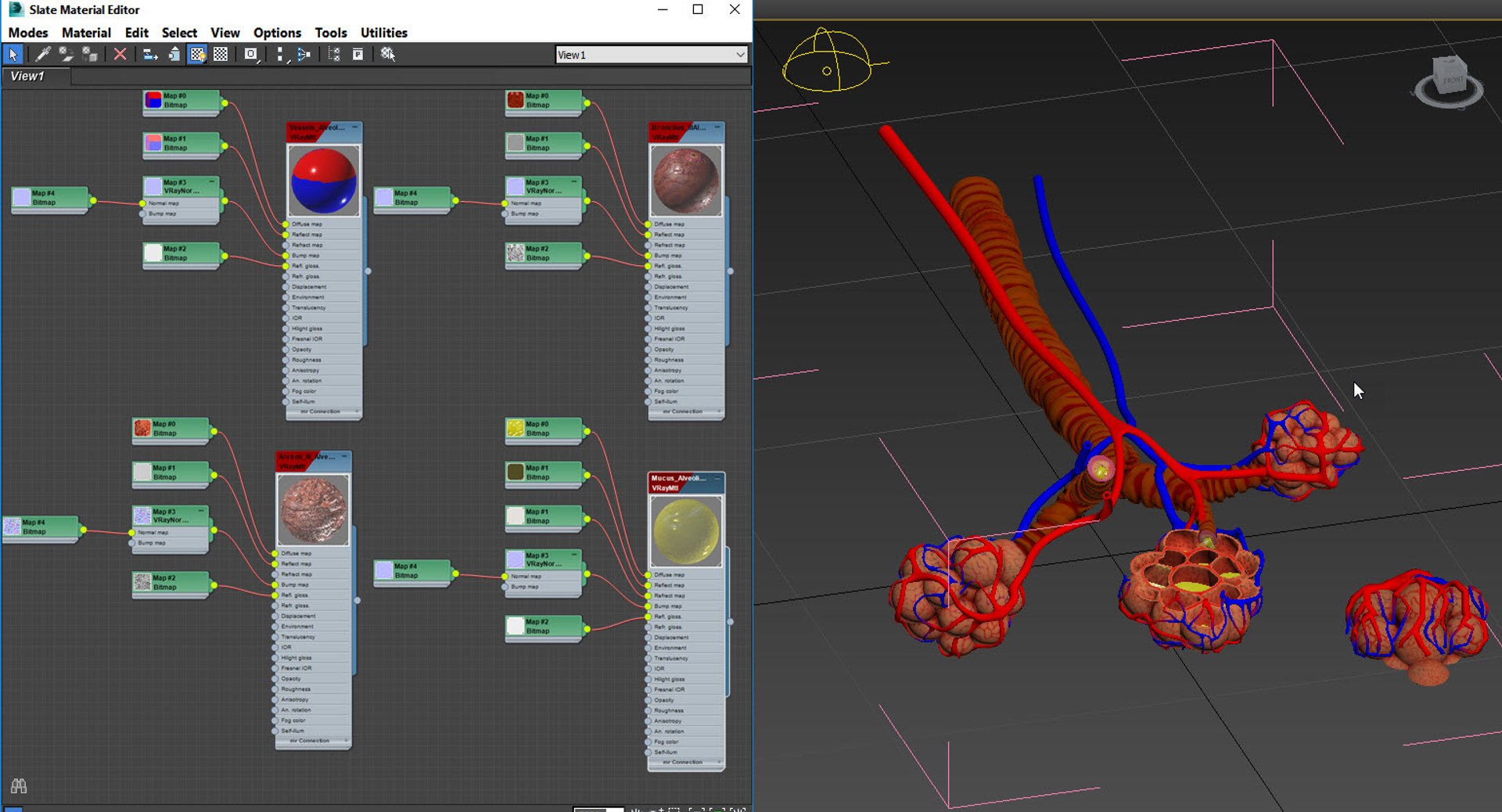 3D Bronchitis Alveoli Mucus Lungs - TurboSquid 1663222