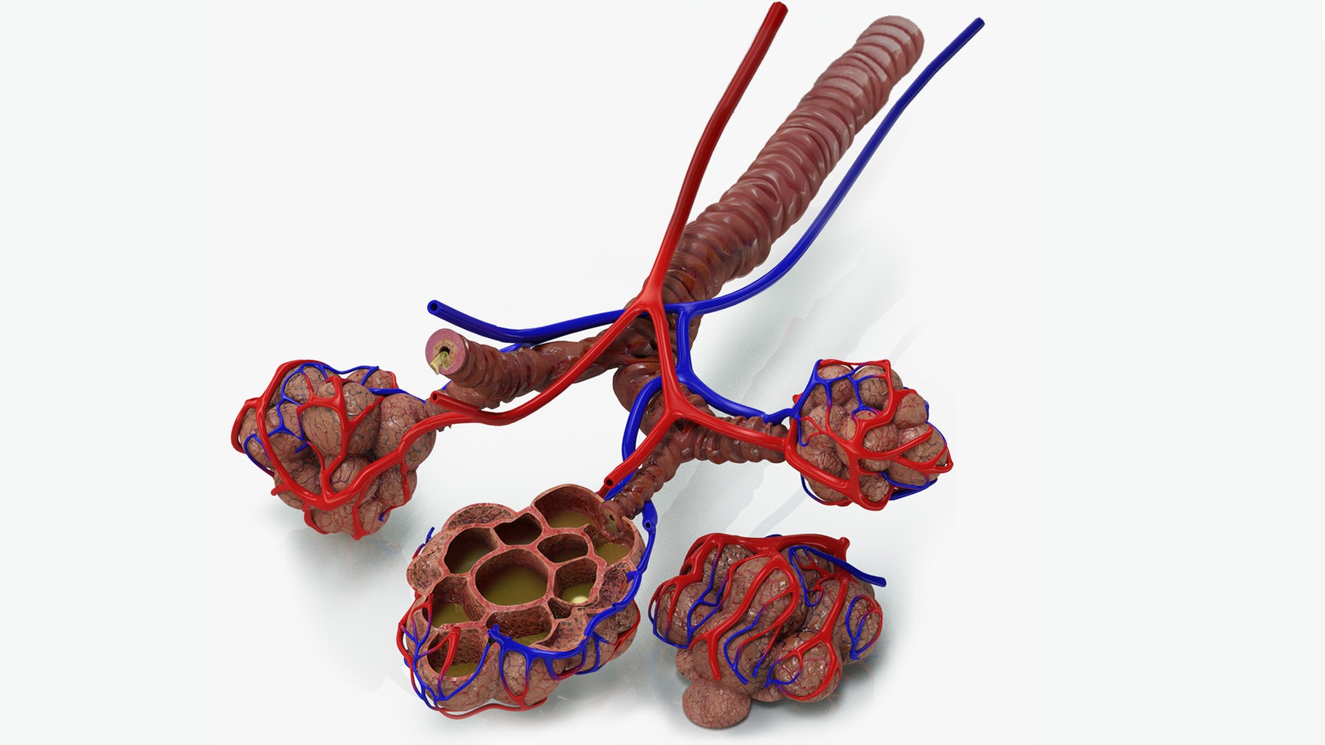 3D Bronchitis Alveoli Mucus Lungs - TurboSquid 1663222