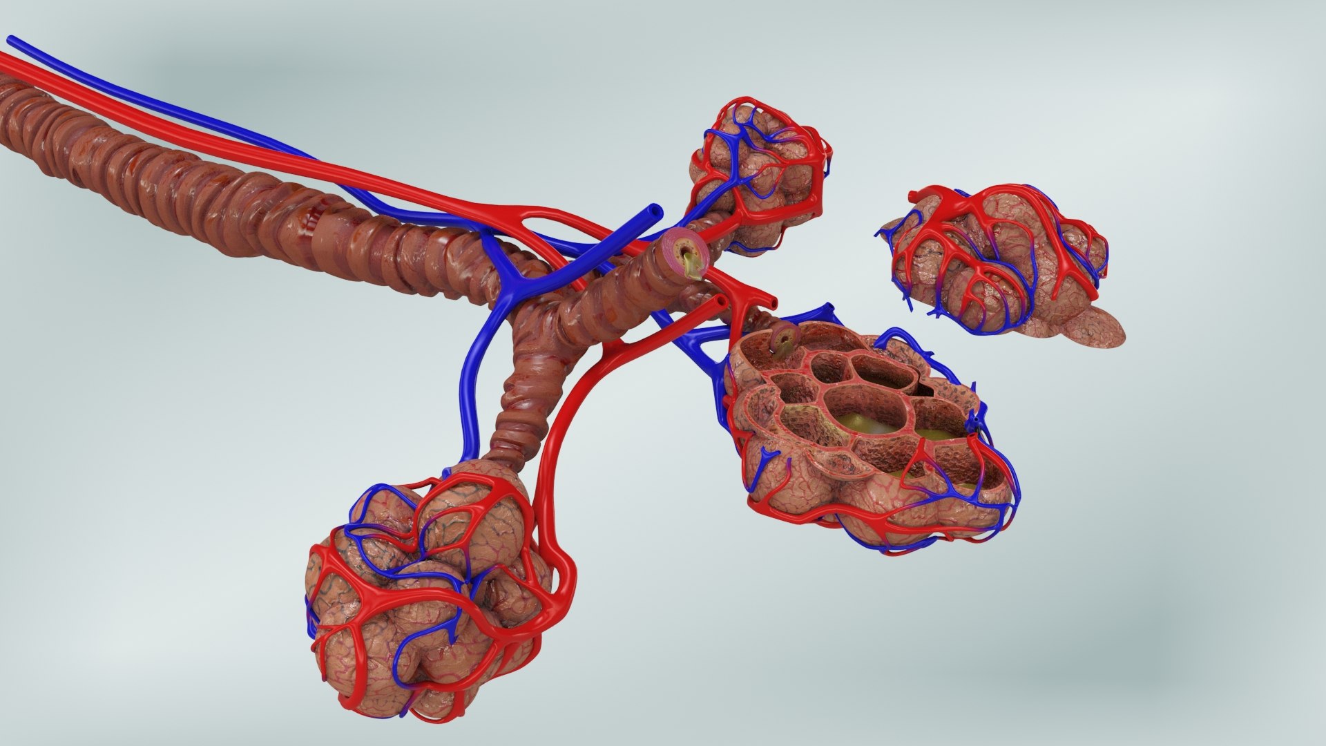 3D Bronchitis Alveoli Mucus Lungs - TurboSquid 1663222