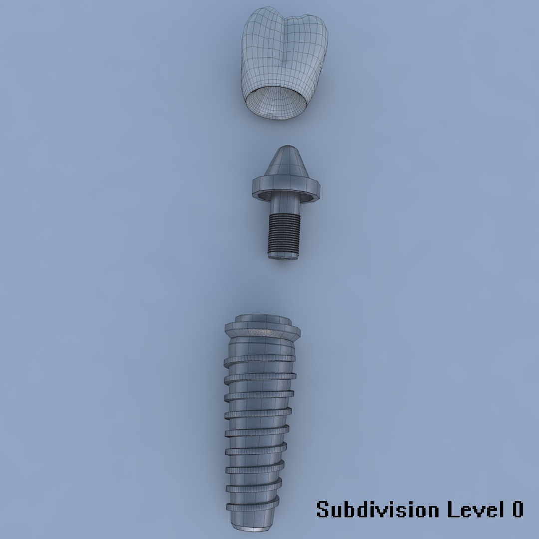 Dental implant 3D model - TurboSquid 1213056