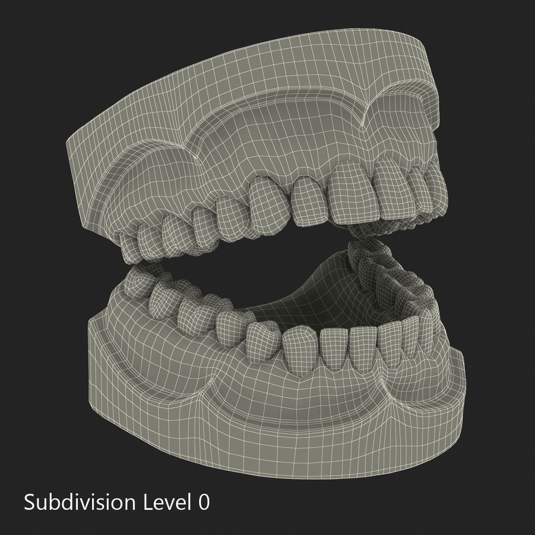 3d Dental Mold Model