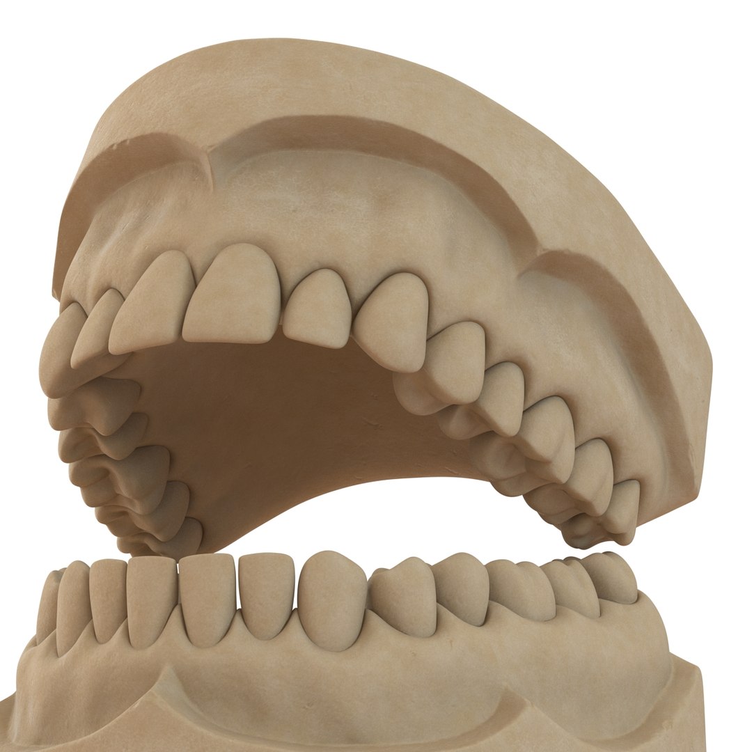 3d Dental Mold Model