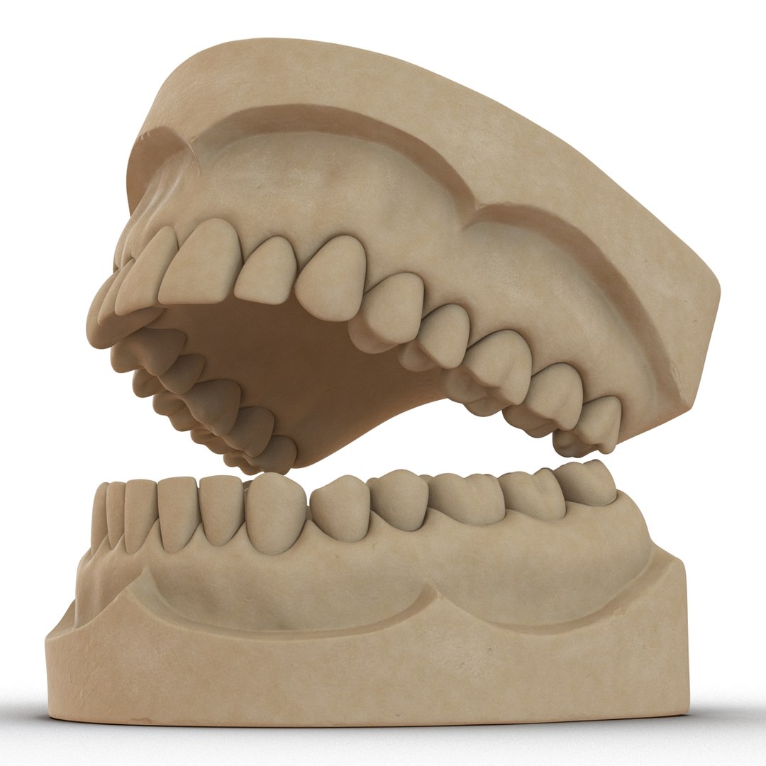 3d Dental Mold Model