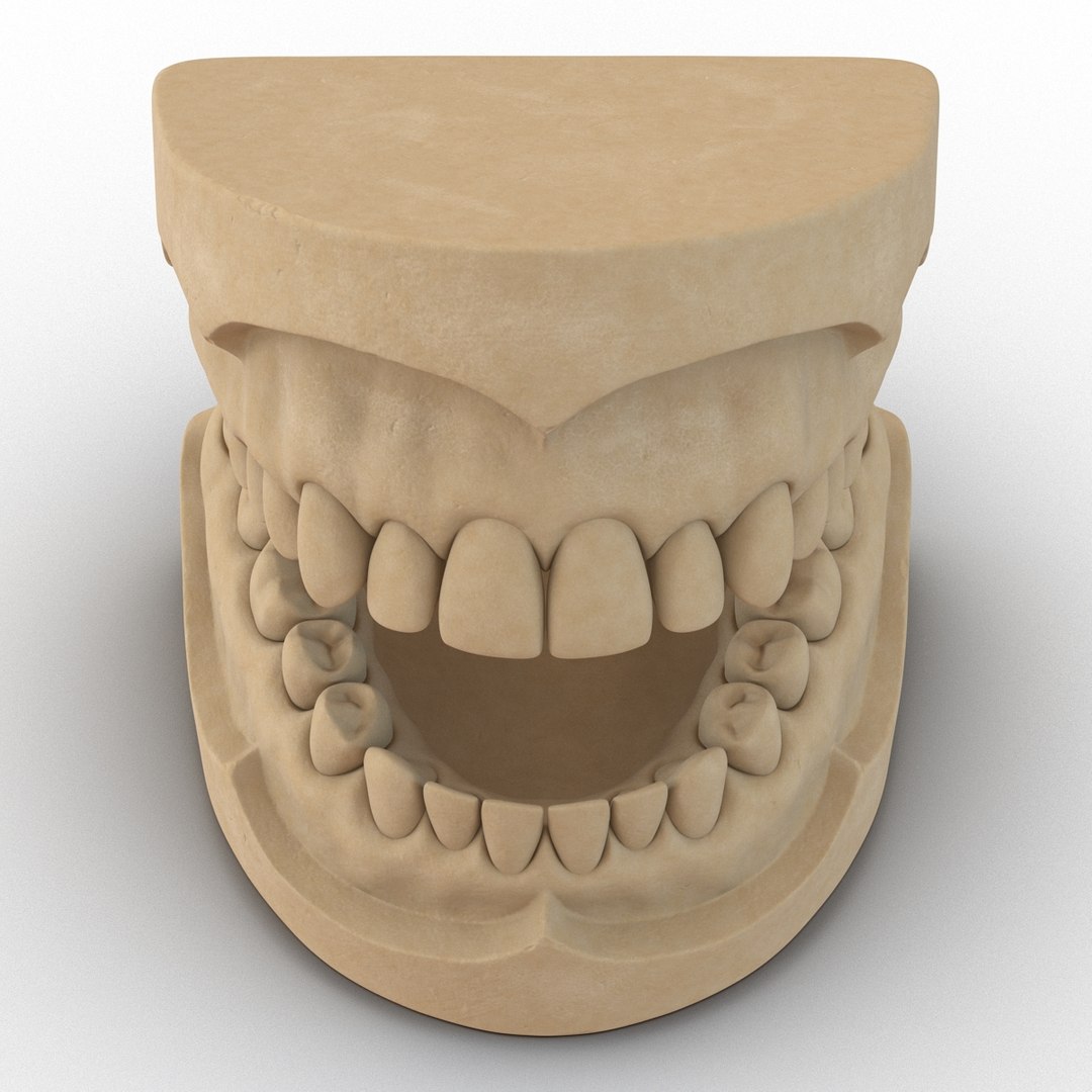 3d Dental Mold Model