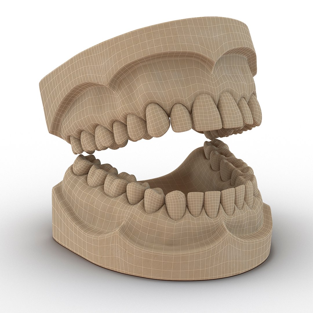 3d Dental Mold Model