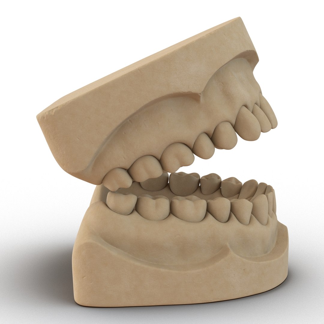 3d Dental Mold Model