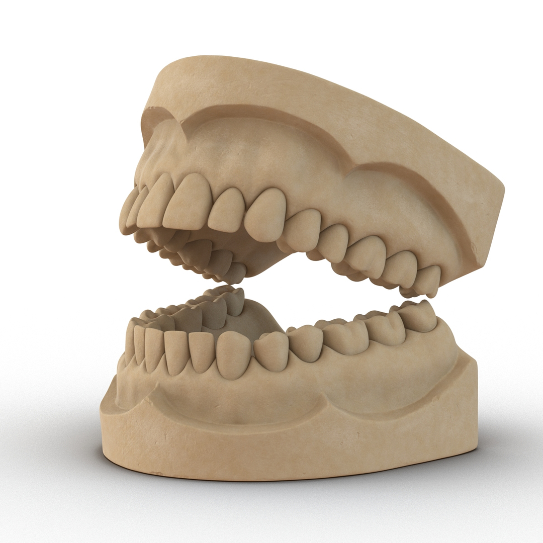 3d Dental Mold Model