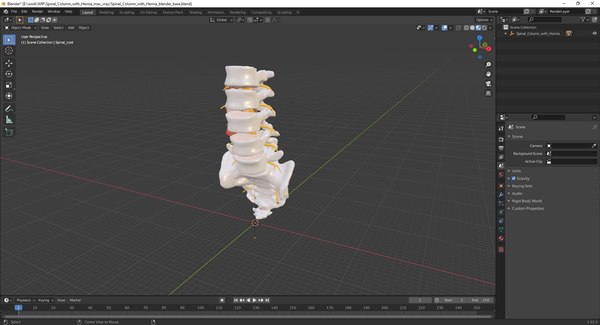 3D Spinal Column with Hernia - TurboSquid 2051010