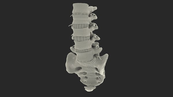 3D Spinal Column with Hernia - TurboSquid 2051010