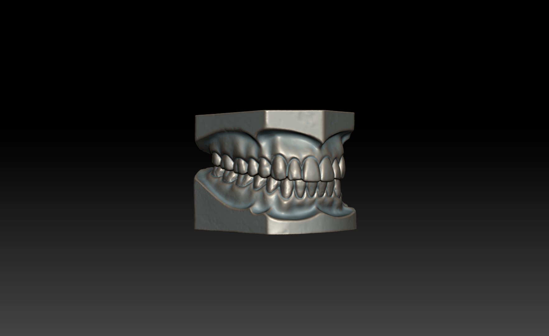 3d Dental Impressions Model
