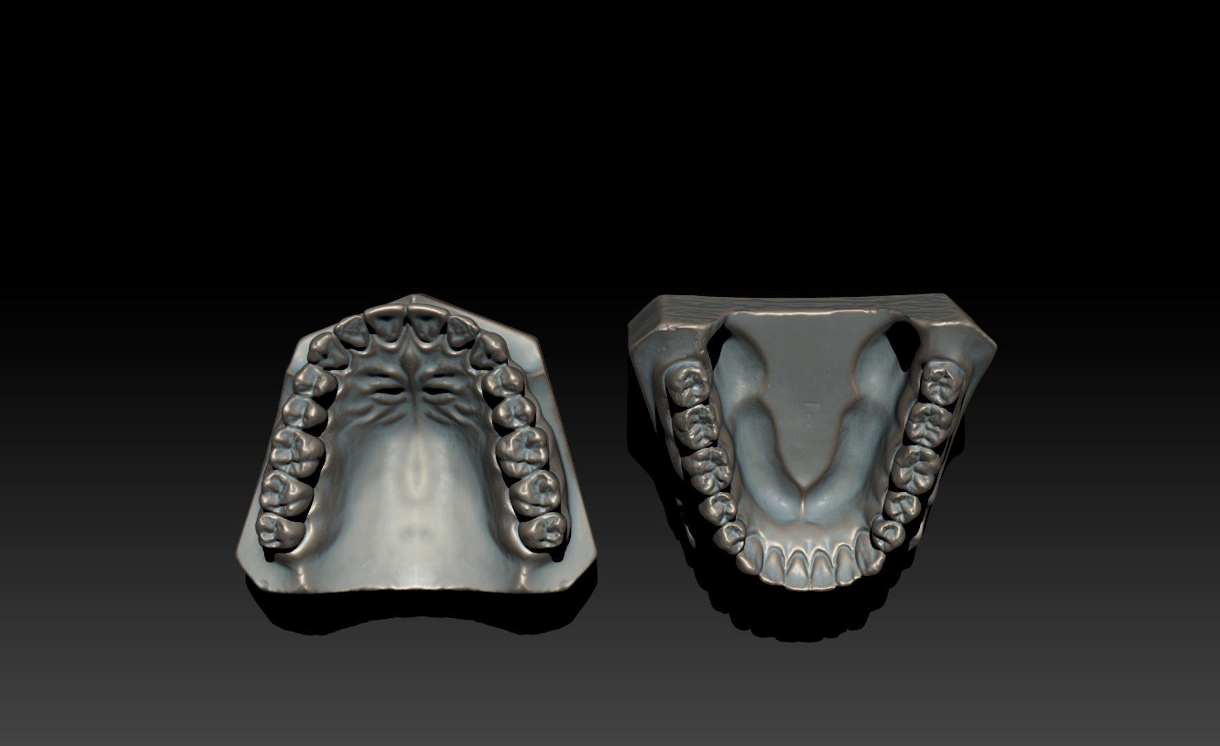 3d Dental Impressions Model