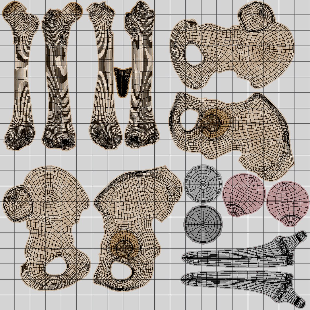 Medical Endoprosthesis 3d Model