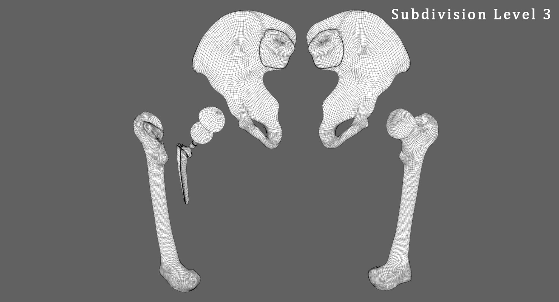 Medical Endoprosthesis 3d Model