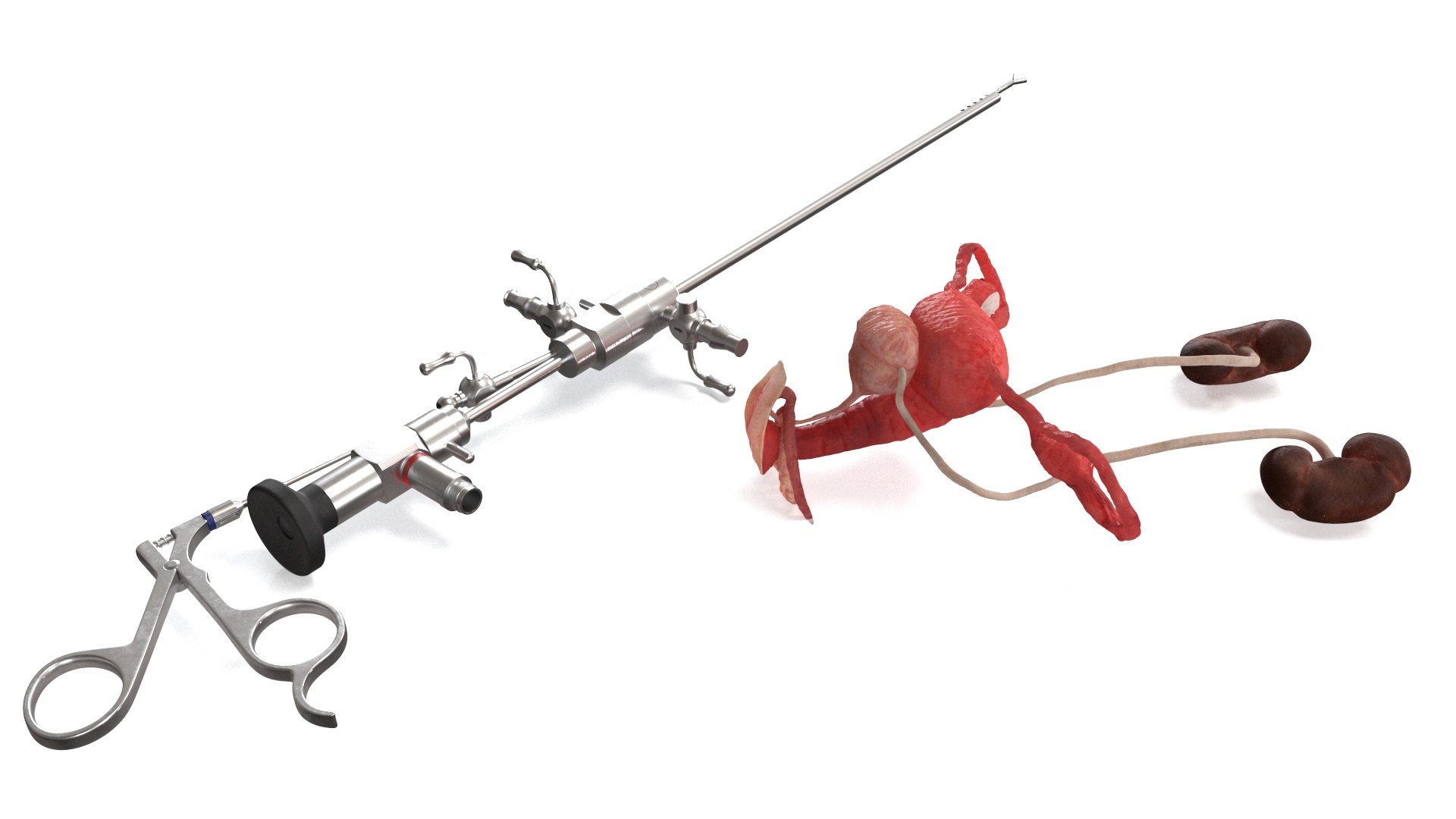 Female Reproductive System Exam By Hysteroscope 3D Model - TurboSquid ...