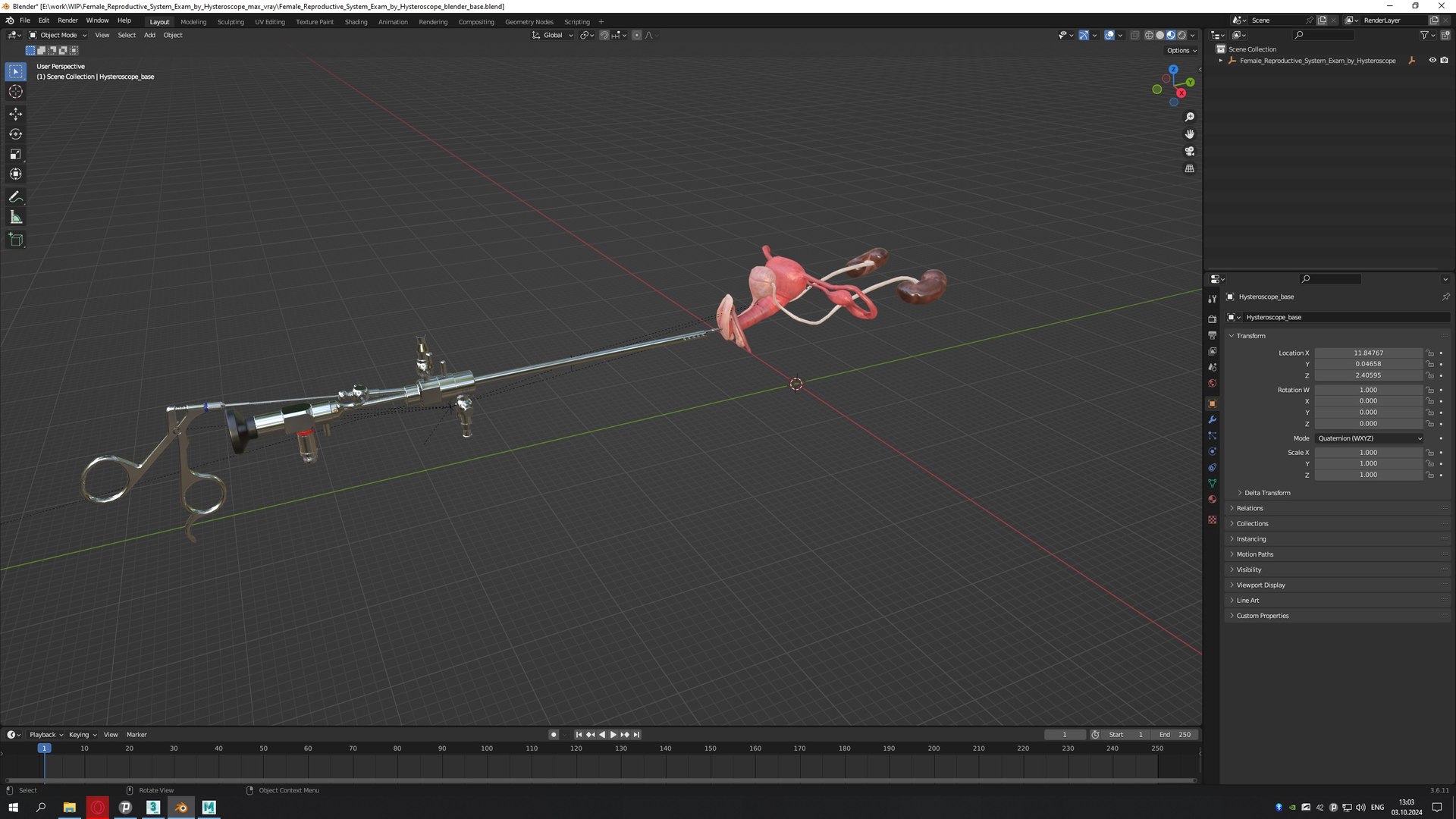 Female Reproductive System Exam By Hysteroscope 3D Model - TurboSquid ...
