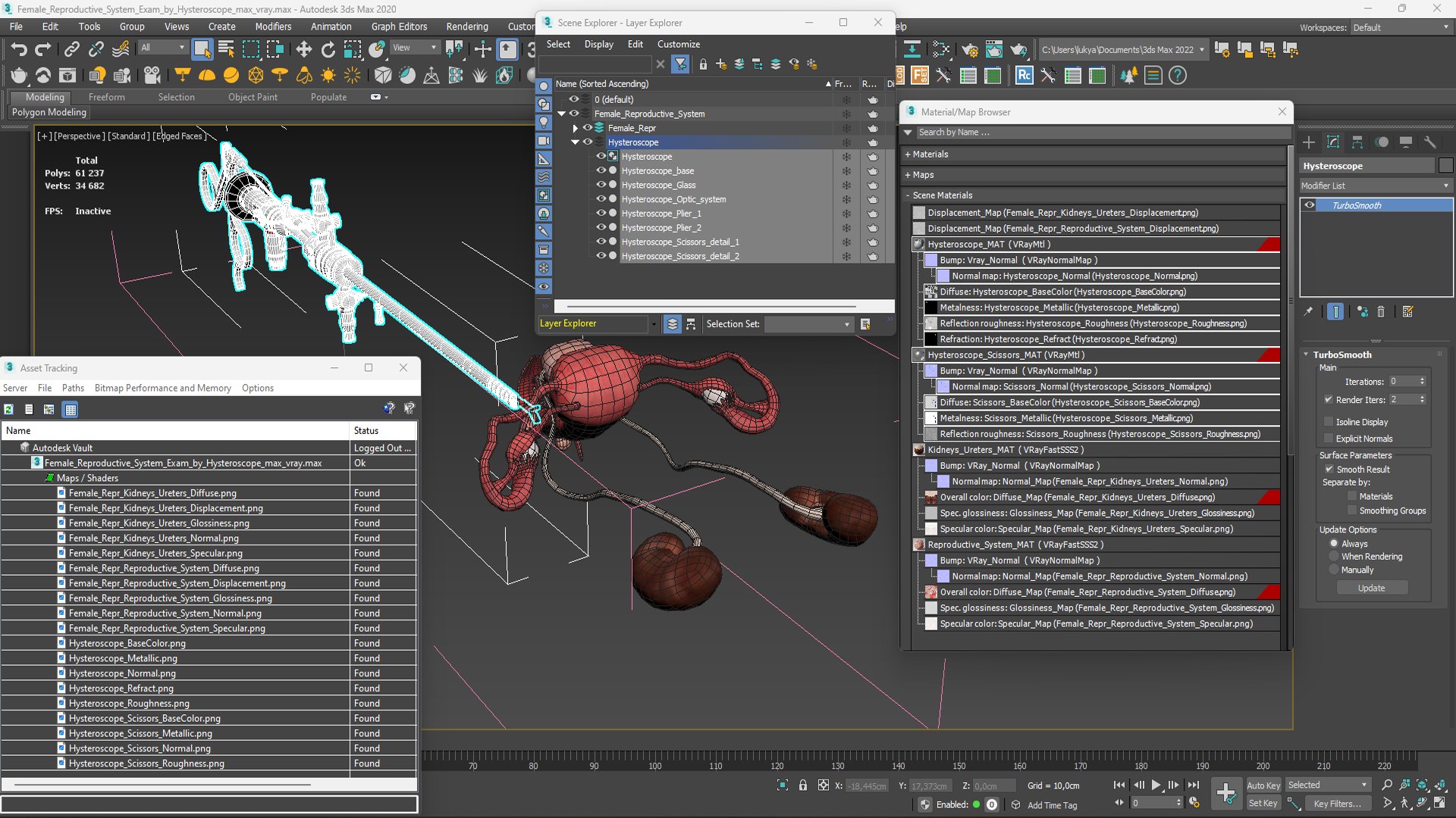 Female Reproductive System Exam By Hysteroscope 3D Model - TurboSquid ...