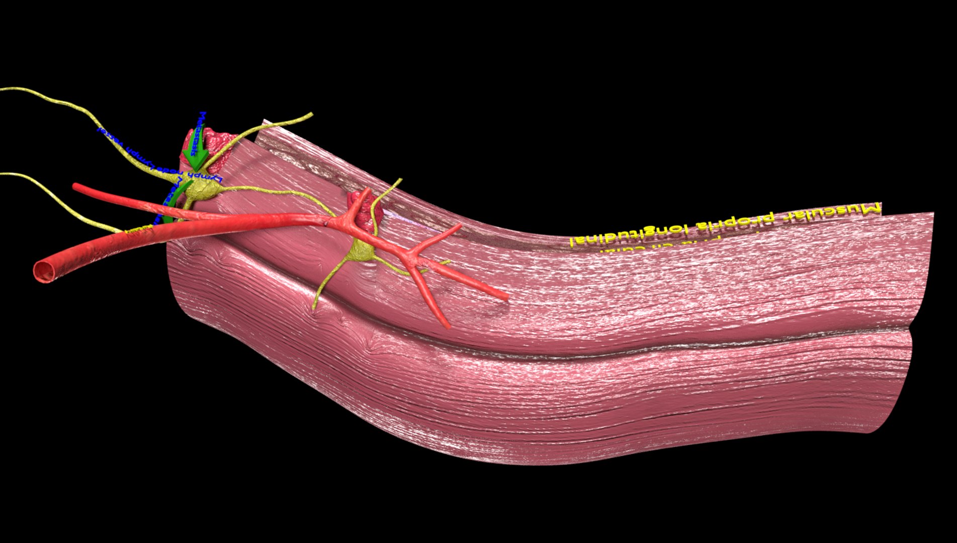 3D Colon Cancer Staging - TurboSquid 1480137