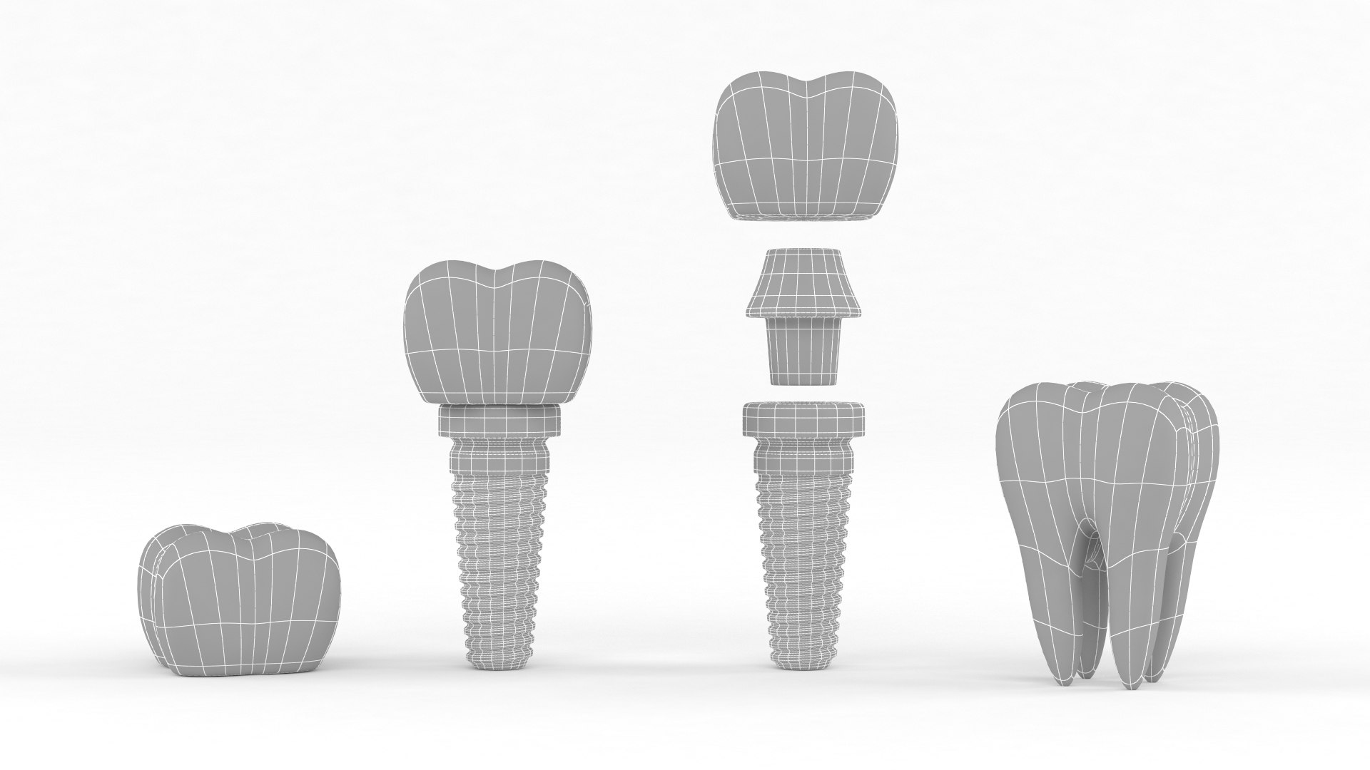 3D Model Tooth Implants - TurboSquid 2356670