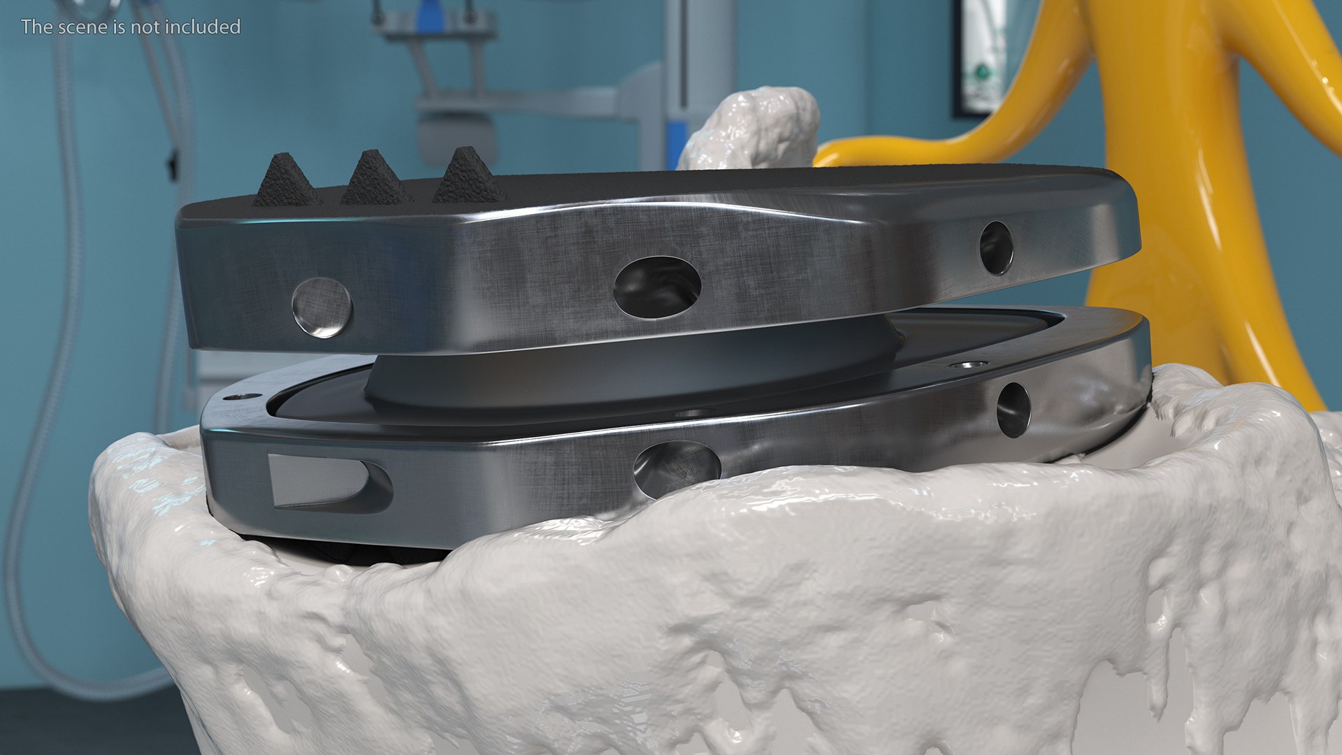 Spinal Lumbar Disc Prosthesis Implant 3D - TurboSquid 2205564