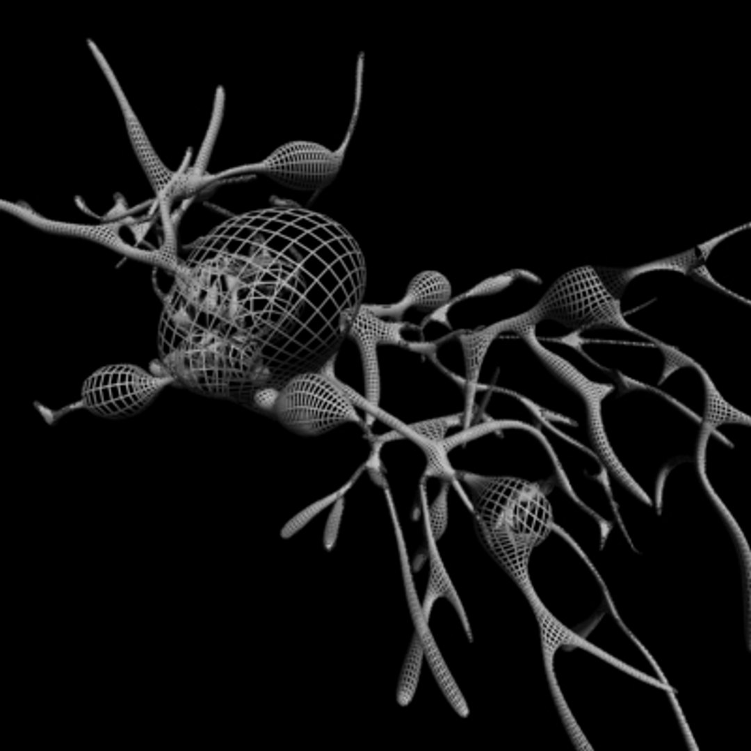 Brain Tumor 3d Model