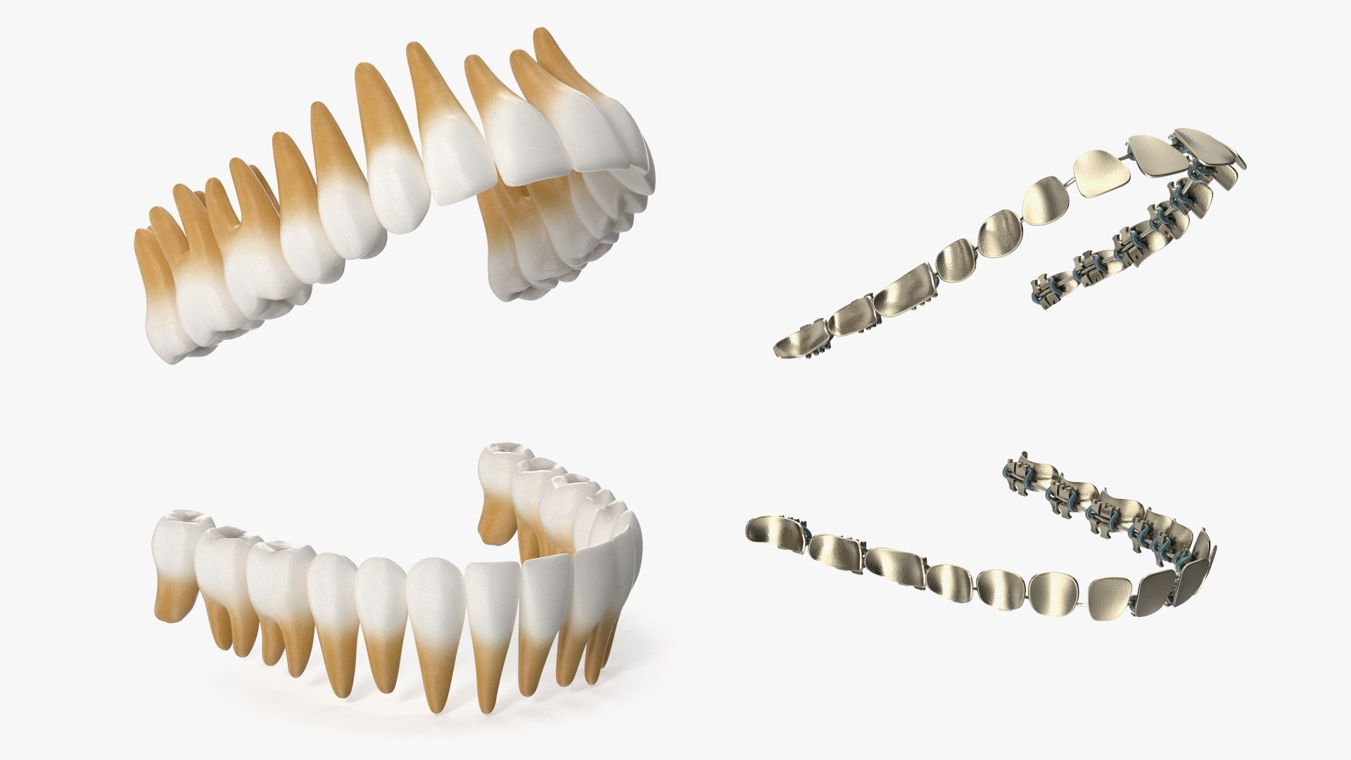 Dental Typodonts With Bracket Collection 3D Model - TurboSquid 2346556