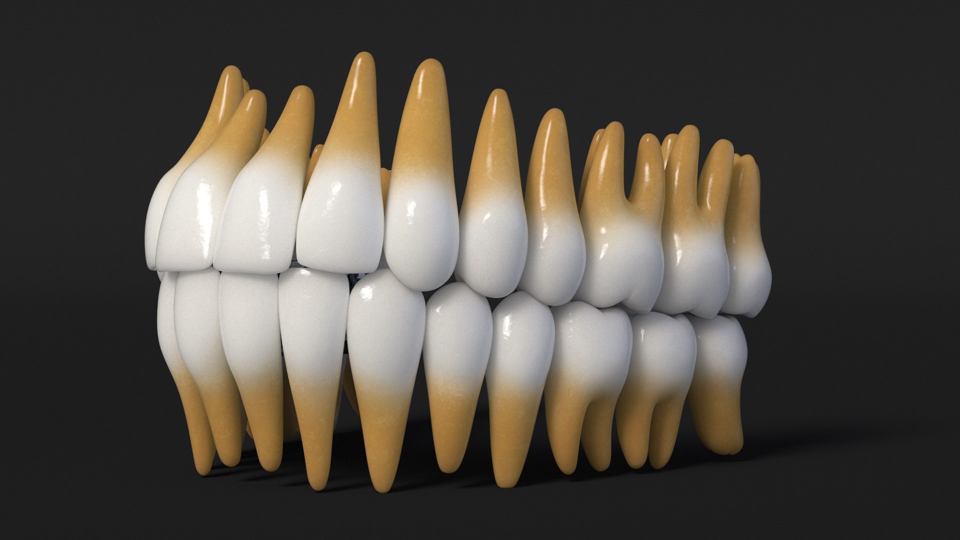 Dental Typodonts With Bracket Collection 3D Model - TurboSquid 2346556