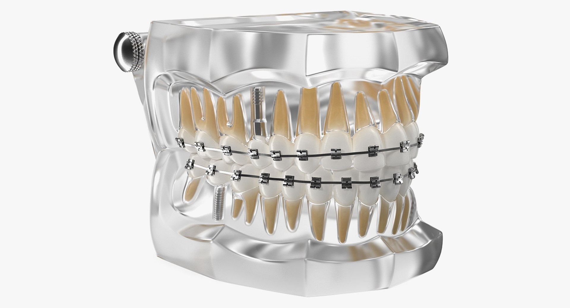 Dental Typodonts With Bracket Collection 3D Model - TurboSquid 2346556