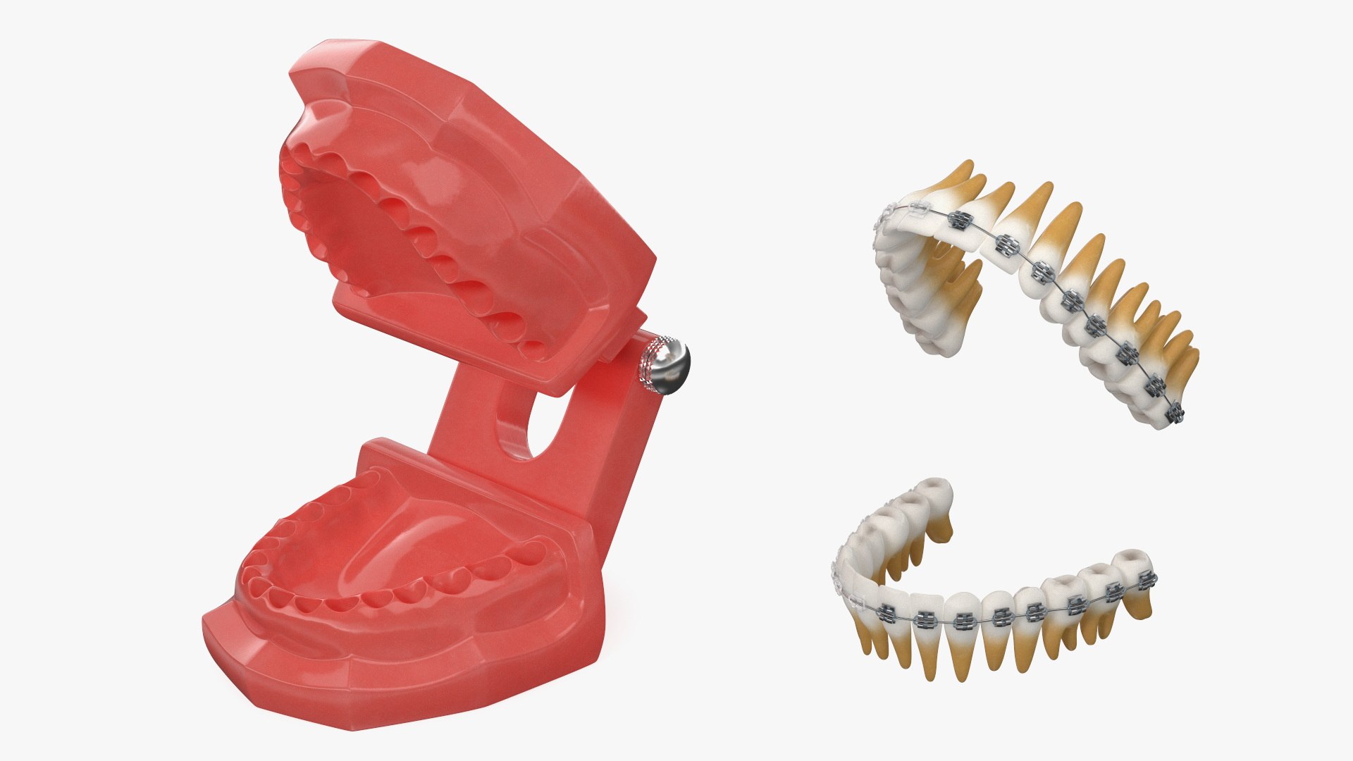 Dental Typodonts With Bracket Collection 3D Model - TurboSquid 2346556