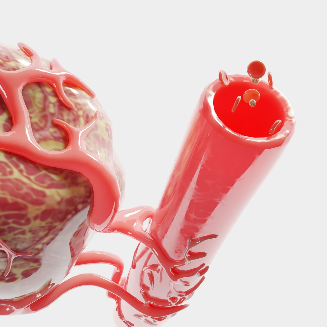 Vessel tumor 3D model - TurboSquid 1659263