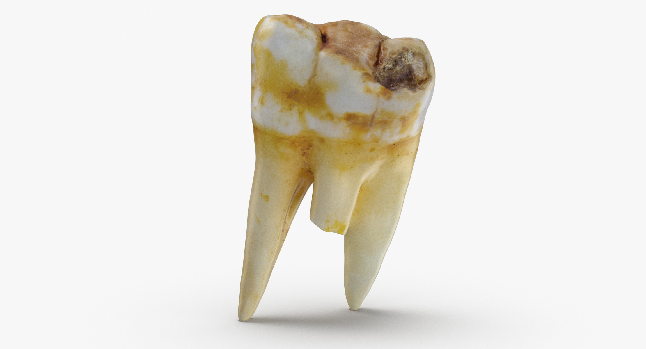 3D model Human Teeth Collection 01 - 43 models - TurboSquid 1753765