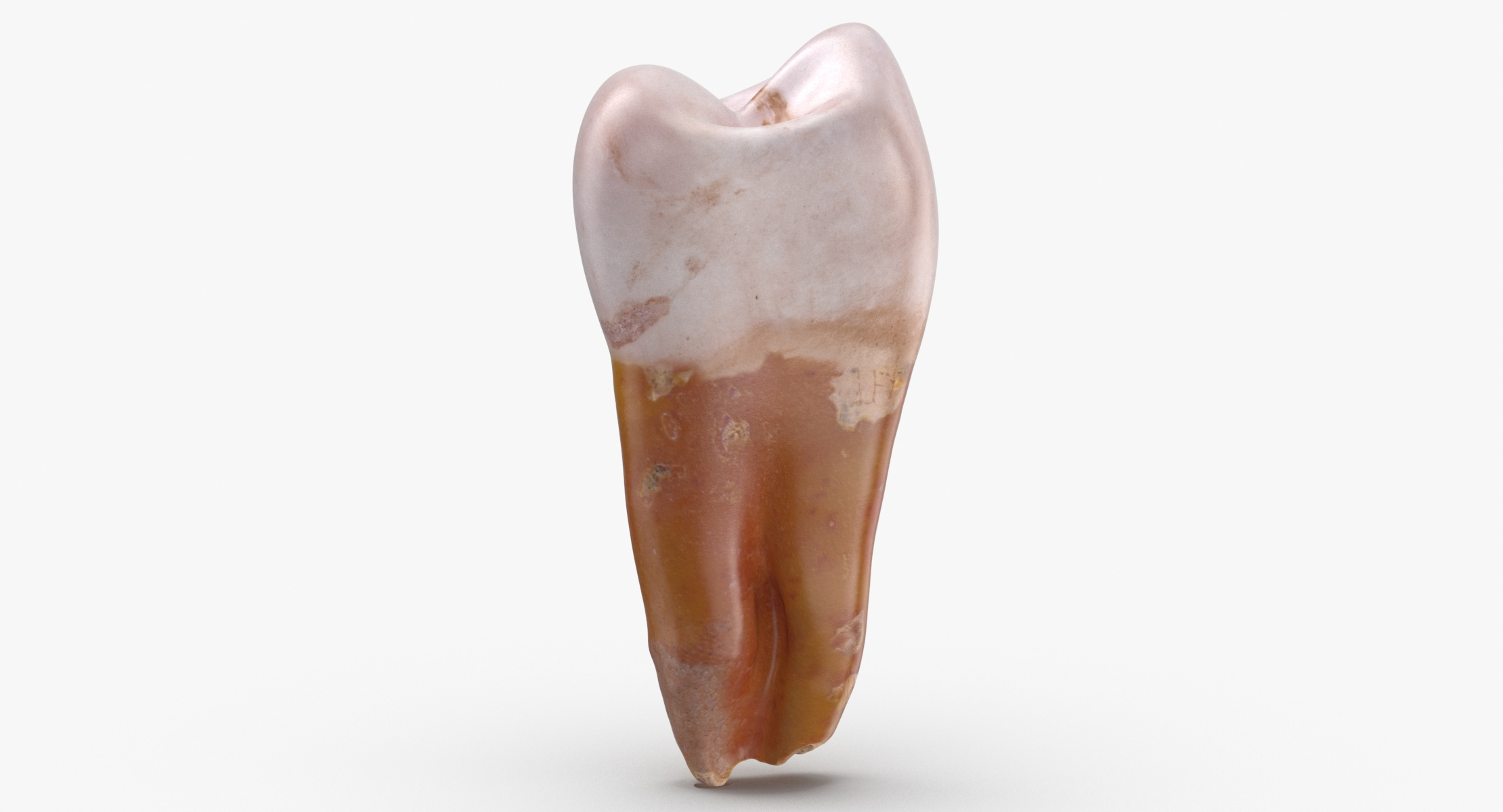 3D model Human Teeth Collection 01 - 43 models - TurboSquid 1753765